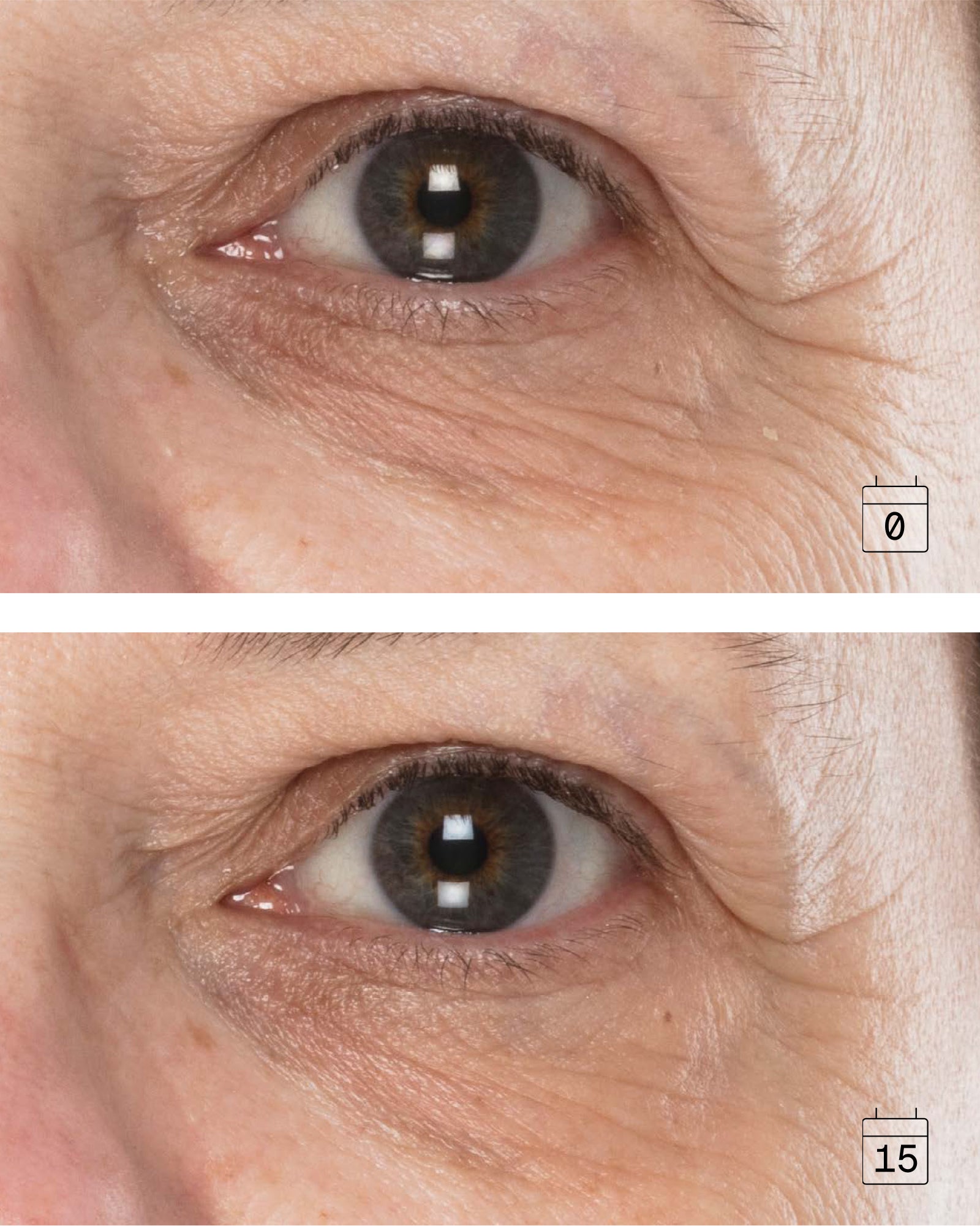 Ultime Eyes | Restructuring and Lifting Cream – IDC